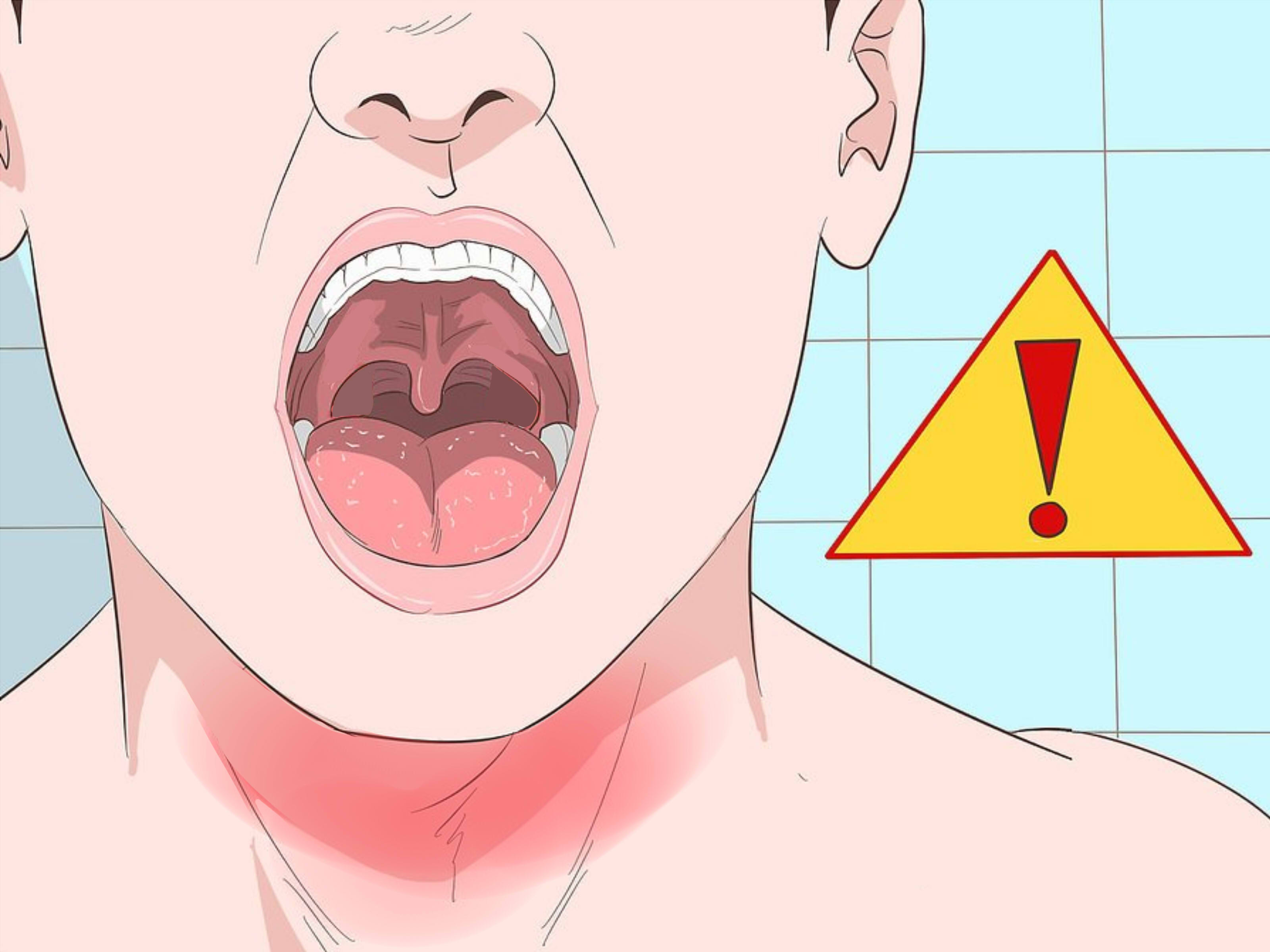 How do I get rid of a sore throat quickly?