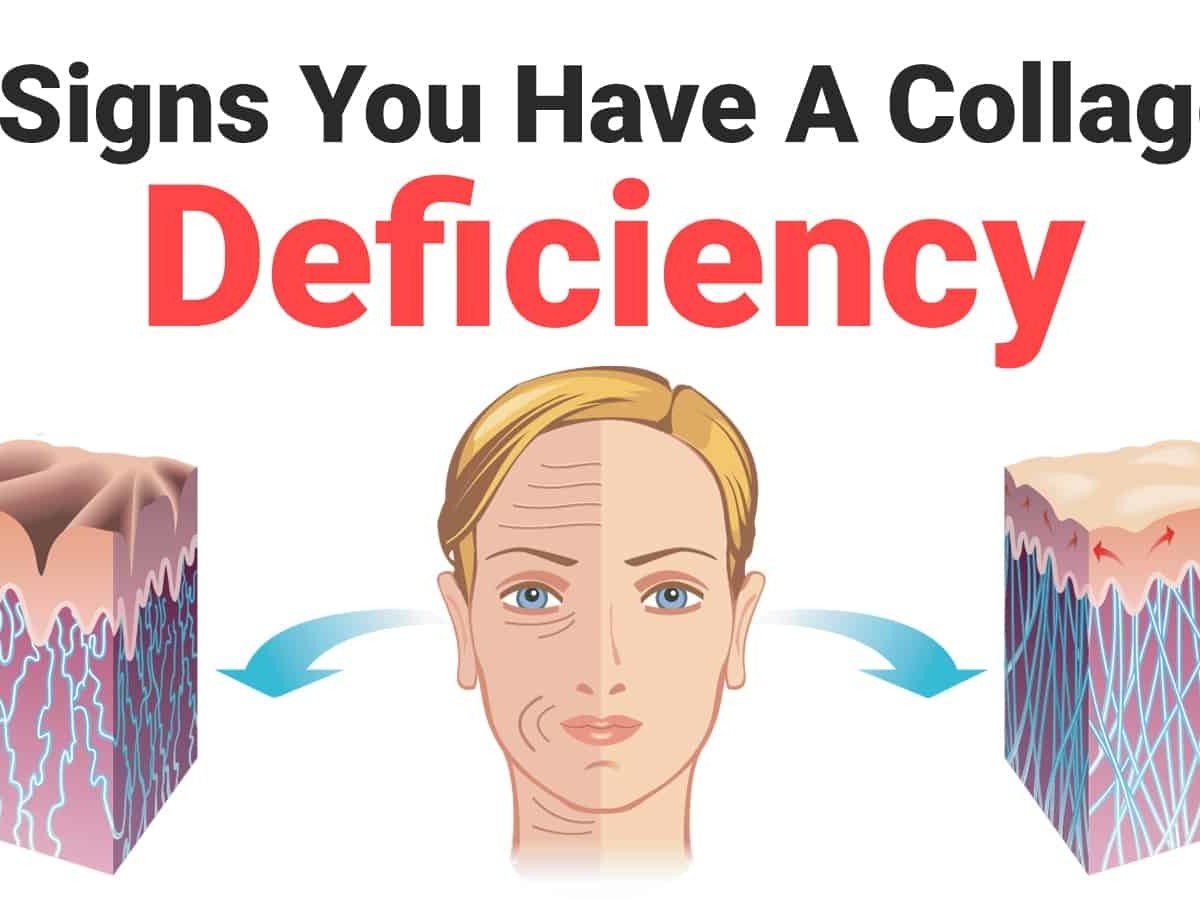 How do I know if I need collagen?