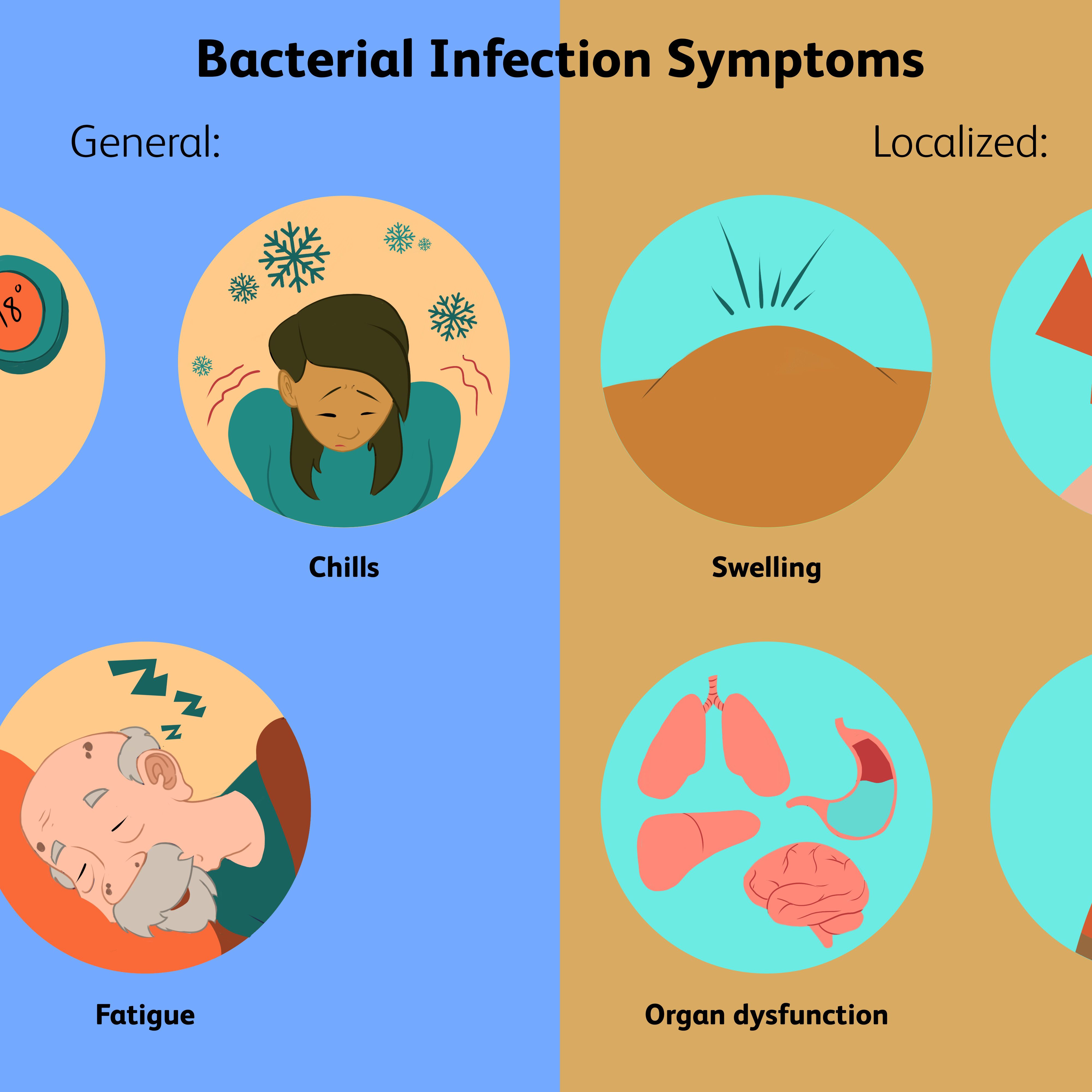 How do I know if my diarrhea is caused by a bacterial infection?