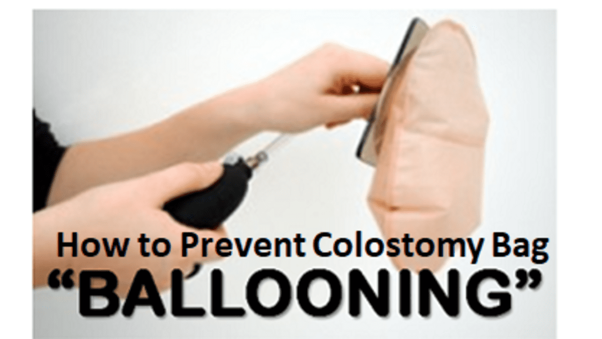 How do I stop my ostomy bag from Ballooning?