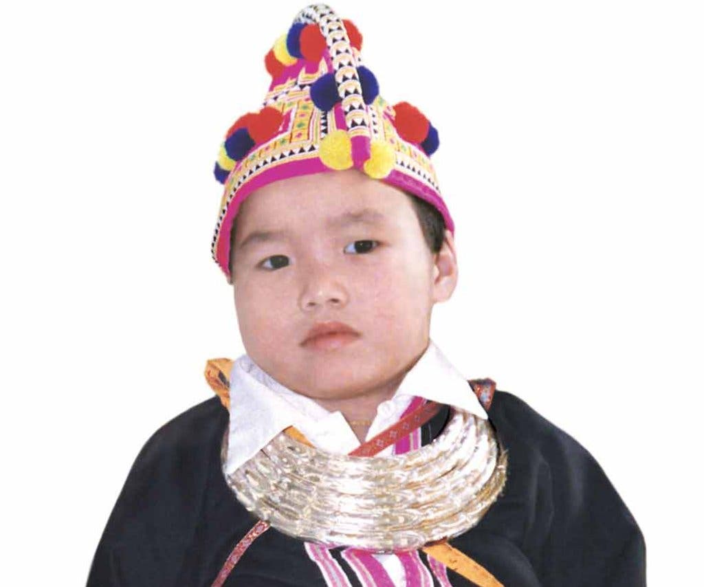 How do the Hmong view epilepsy?