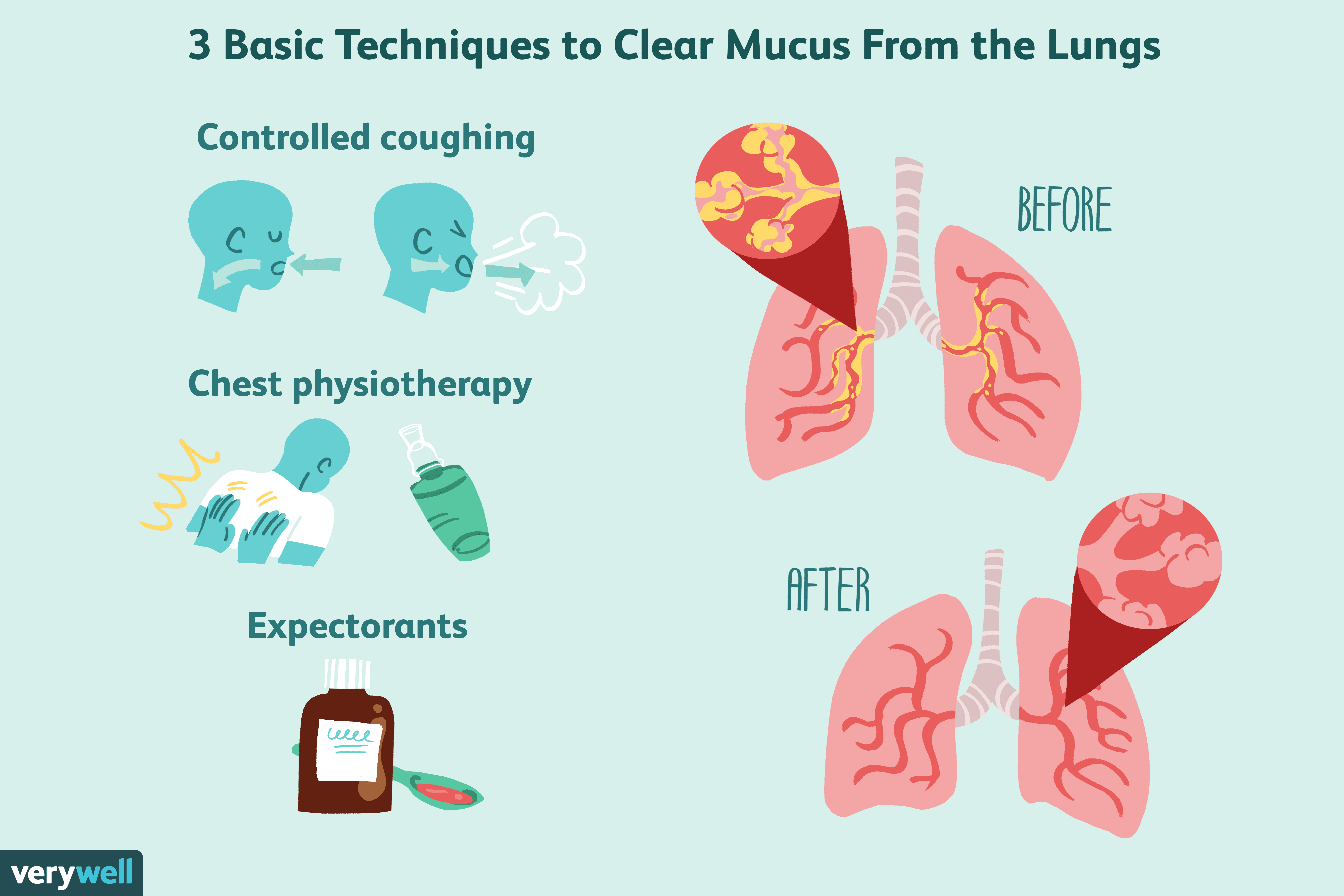 How do you cough up mucus fast?