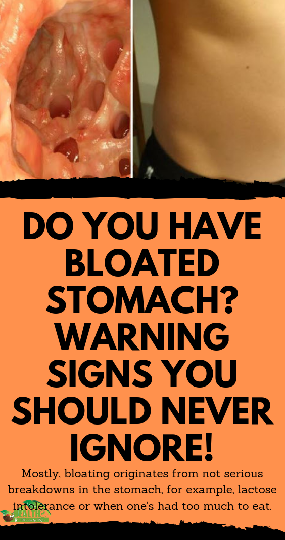 How do you cure a bloated stomach?