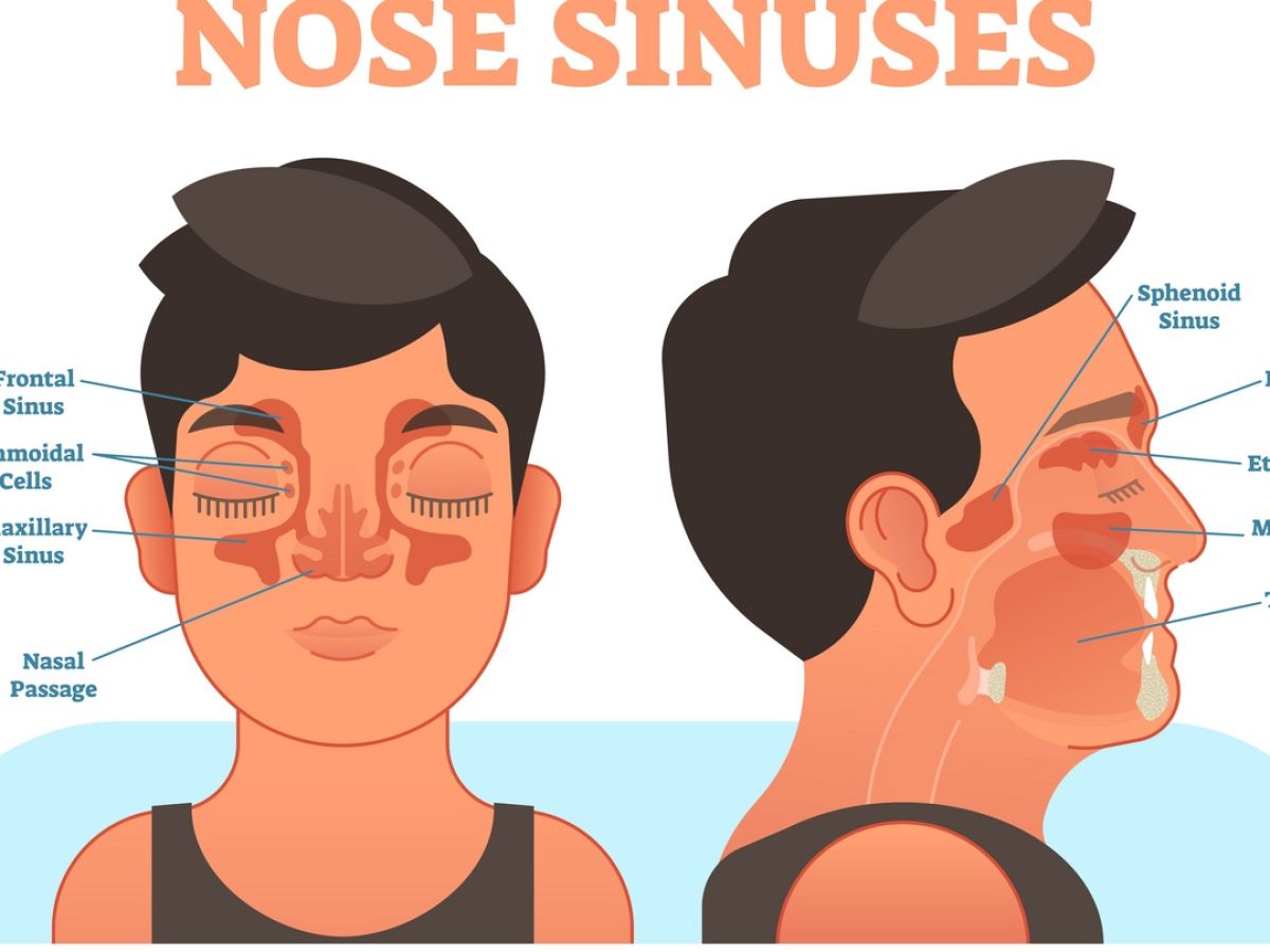 How do you detox your sinuses?