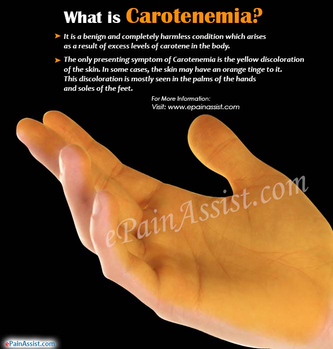 How do you fix carotenemia?