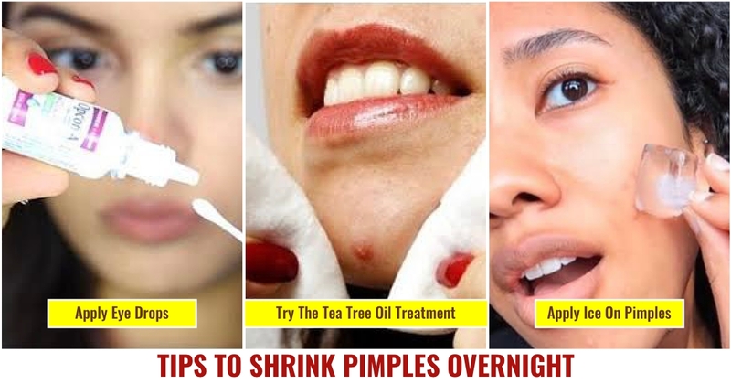 How do you get rid of a pimple overnight?