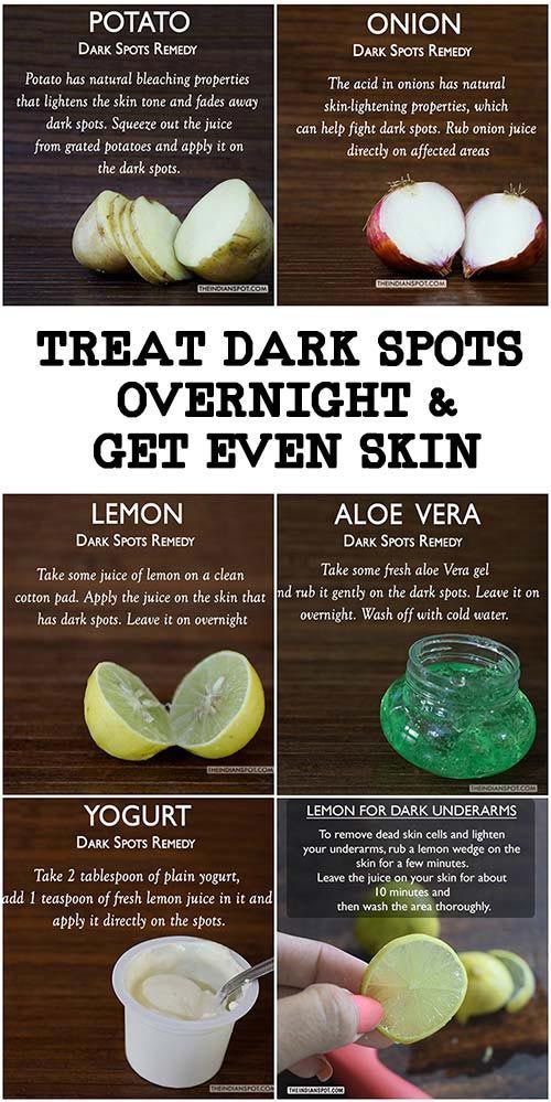 How do you get rid of dark spots overnight?