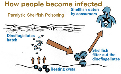 How do you get rid of paralytic shellfish poisoning?