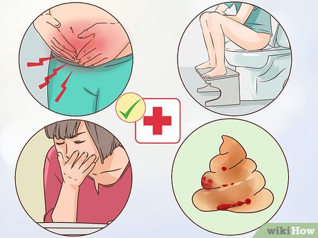 How do you get rid of smelly flatulence?