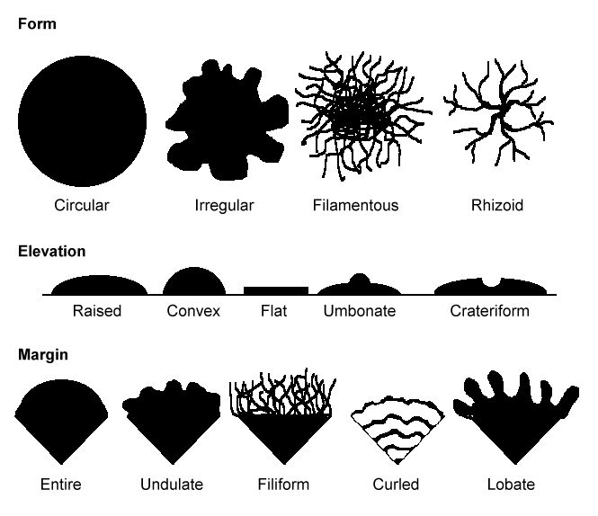 How do you identify bacterial growth?