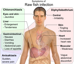 How do you know if you have parasites from sushi?