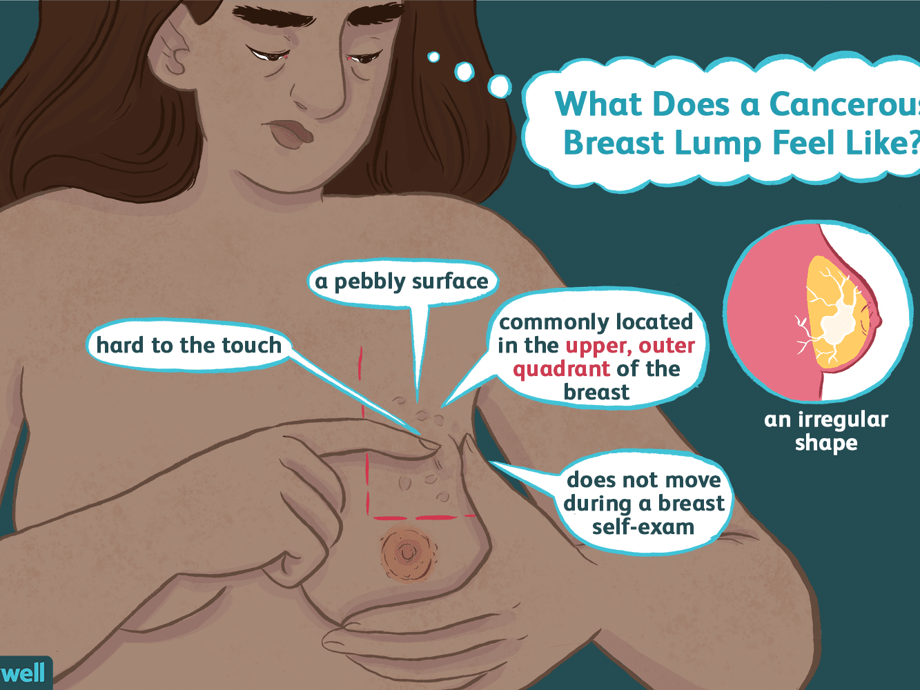 How do you know its a lump?