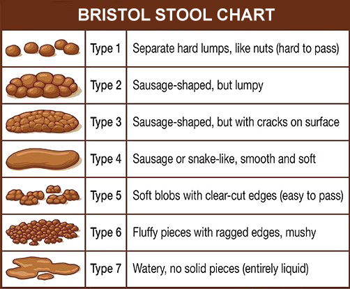 How do you know when constipation is serious?