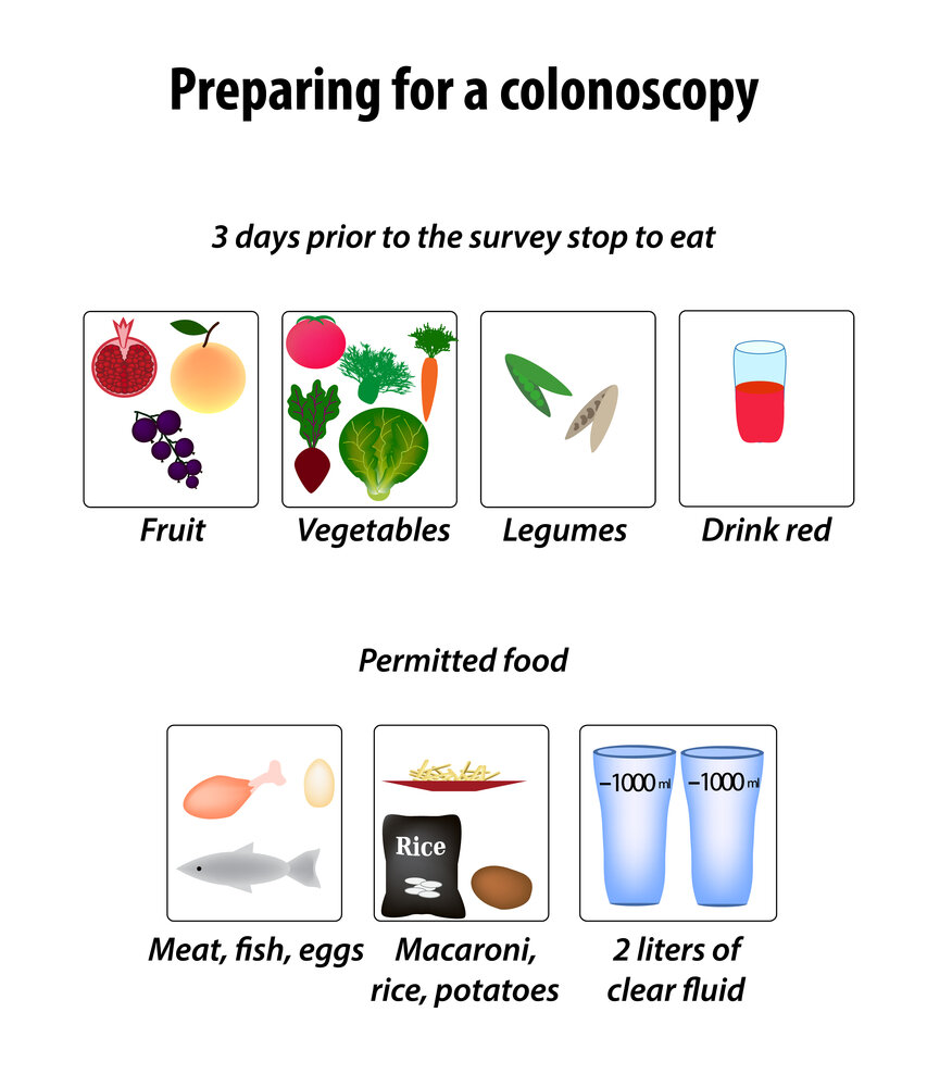 How do you prepare for a 2 day colonoscopy?