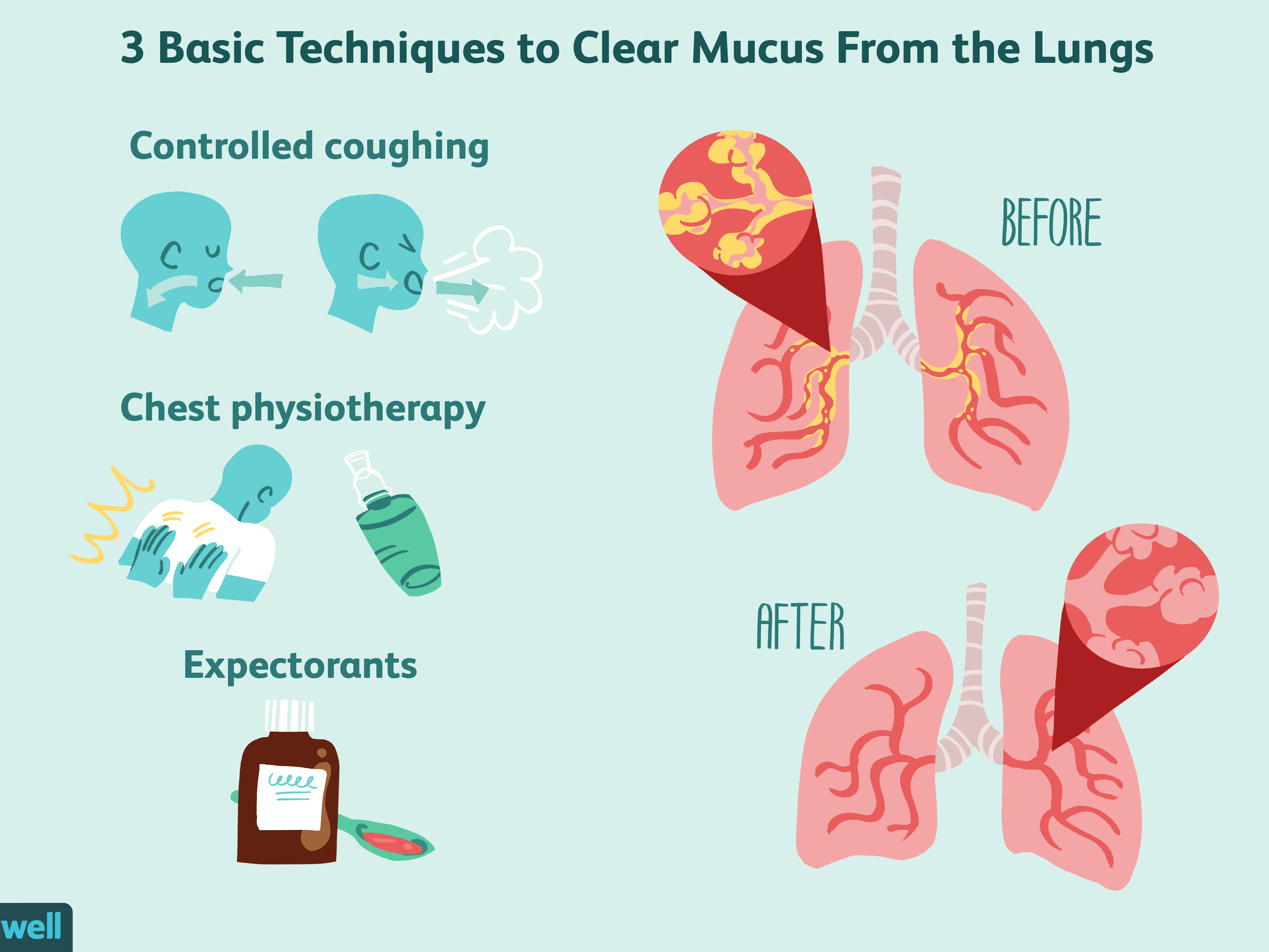 How do you remove mucus from your body?