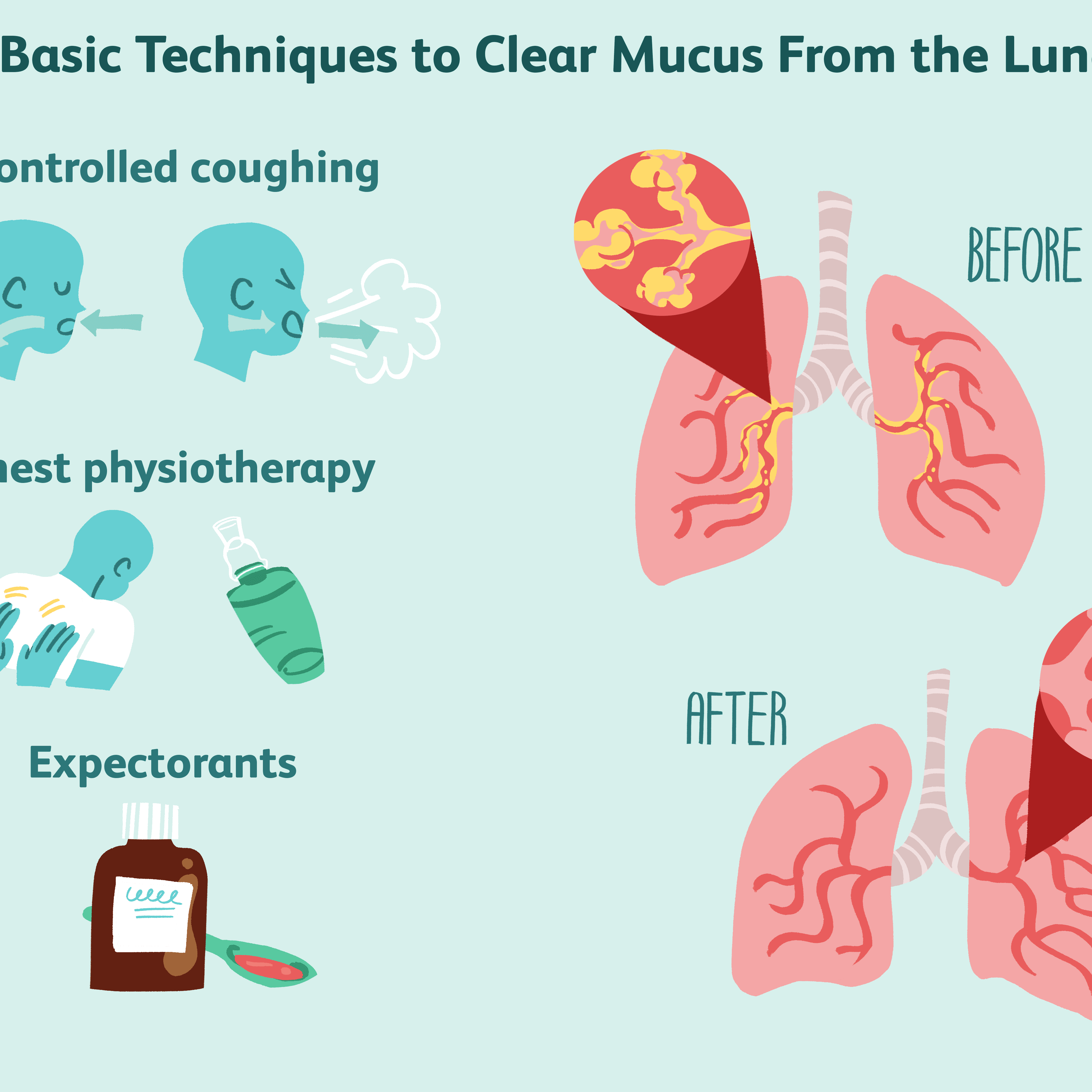 How do you throw out mucus?