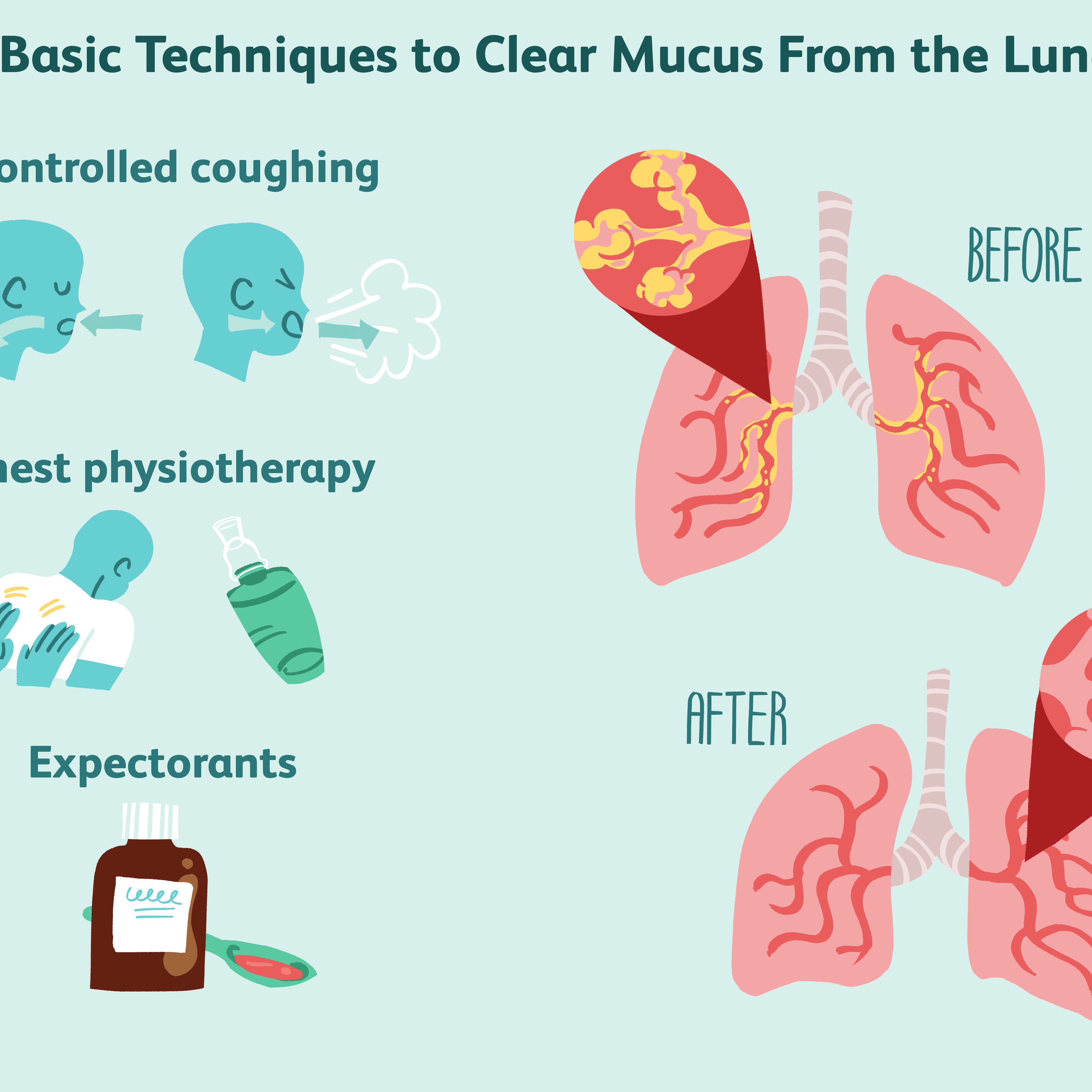 How do you throw up mucus?