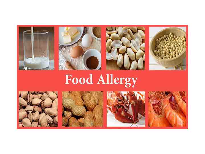 How do you treat soy allergy?