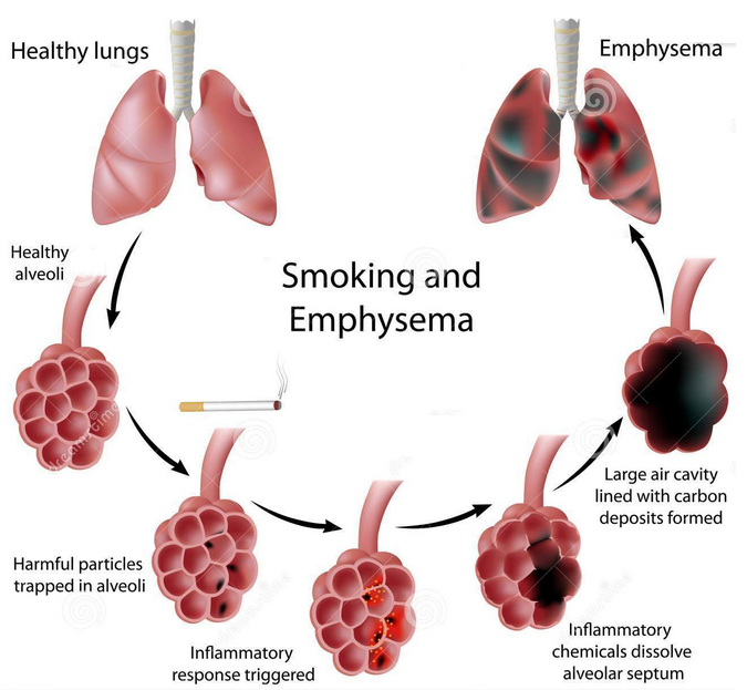 How does smoking affect gas exchange in the lungs?