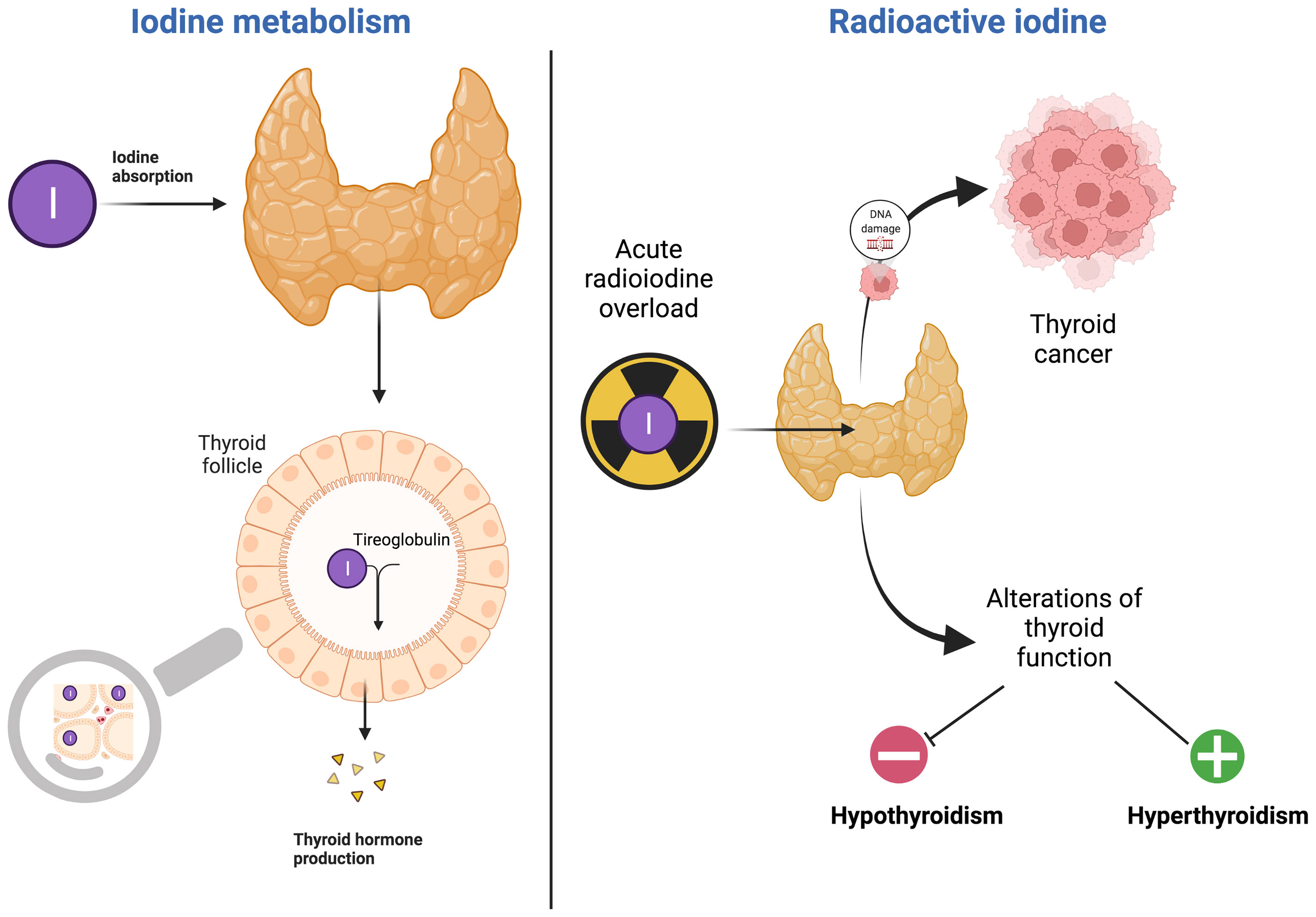 How is radioactive iodine excreted?