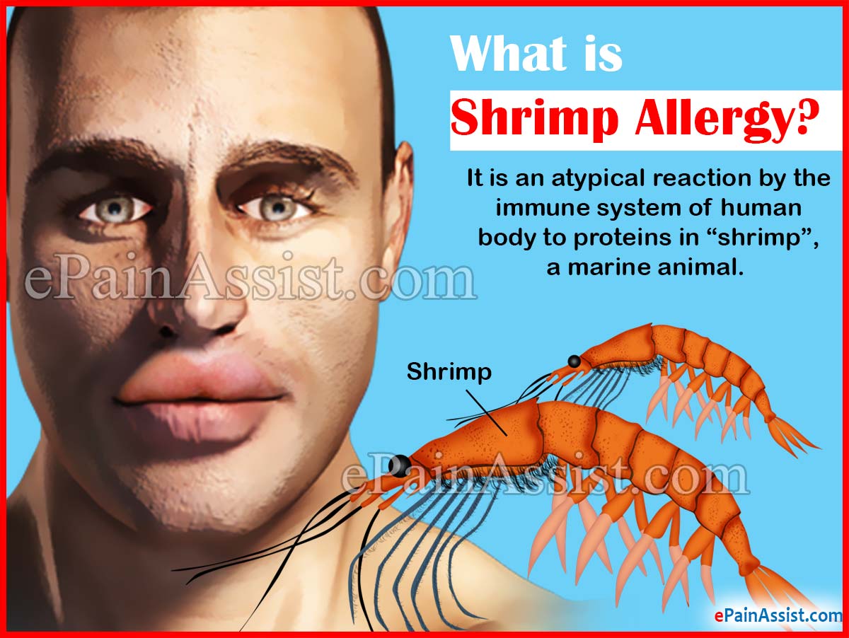 How long after eating shrimp can you have an allergic reaction?