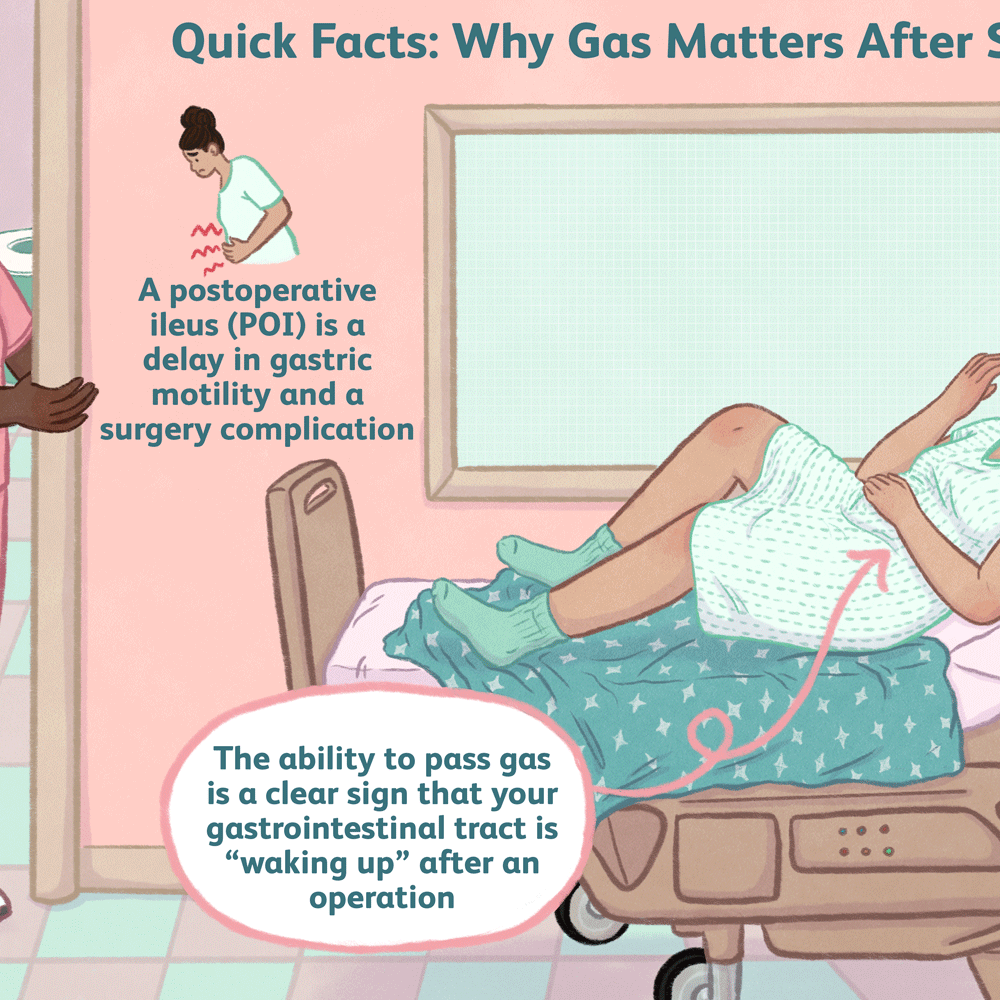 How long are you gassy after surgery?