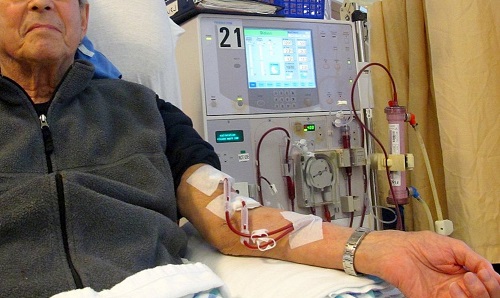 How long can a 80 year old live with kidney failure without dialysis?