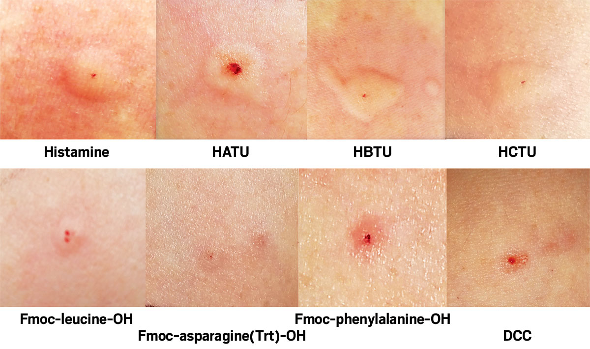 How long do allergic reactions take to start?