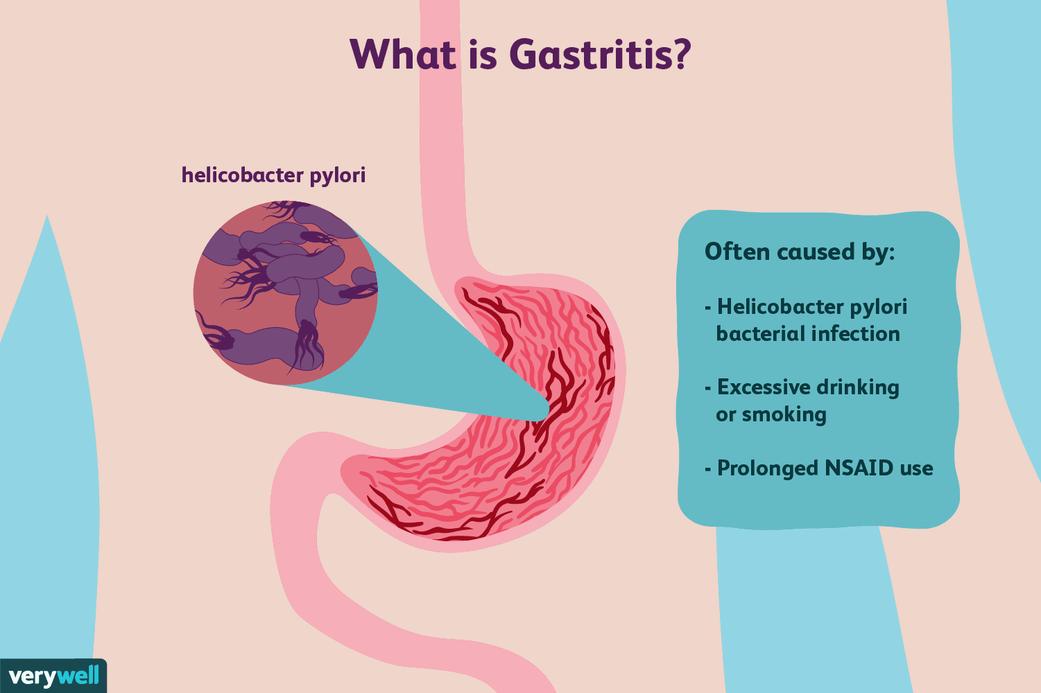 How long does gastritis take to heal?