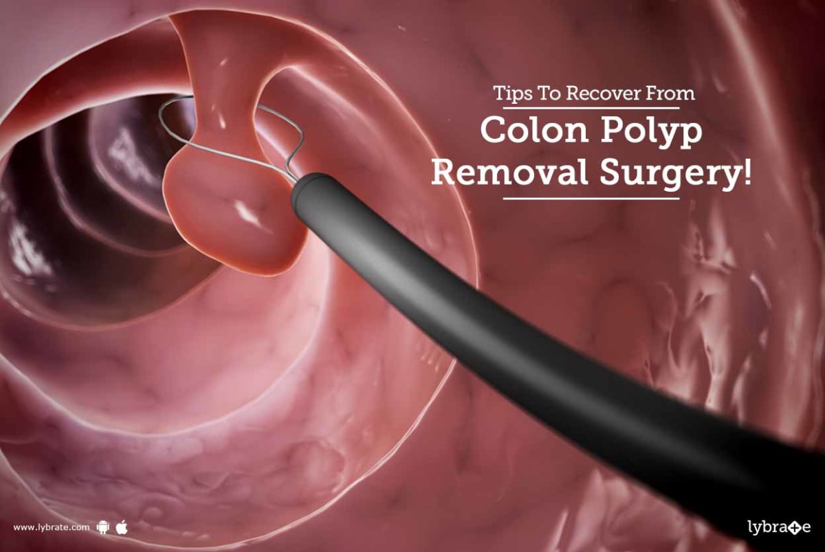 How long does it take for colon to heal after polyp removal?