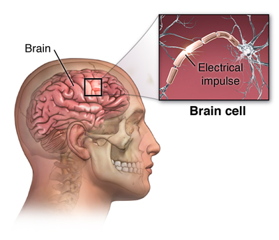 How long does it take to get brain damage from a seizure?