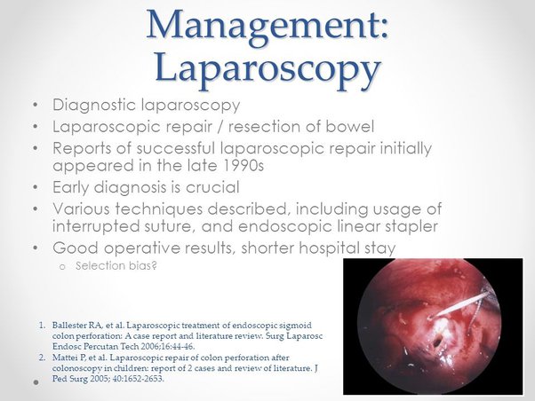 How long does your stomach stay bloated after a colonoscopy?