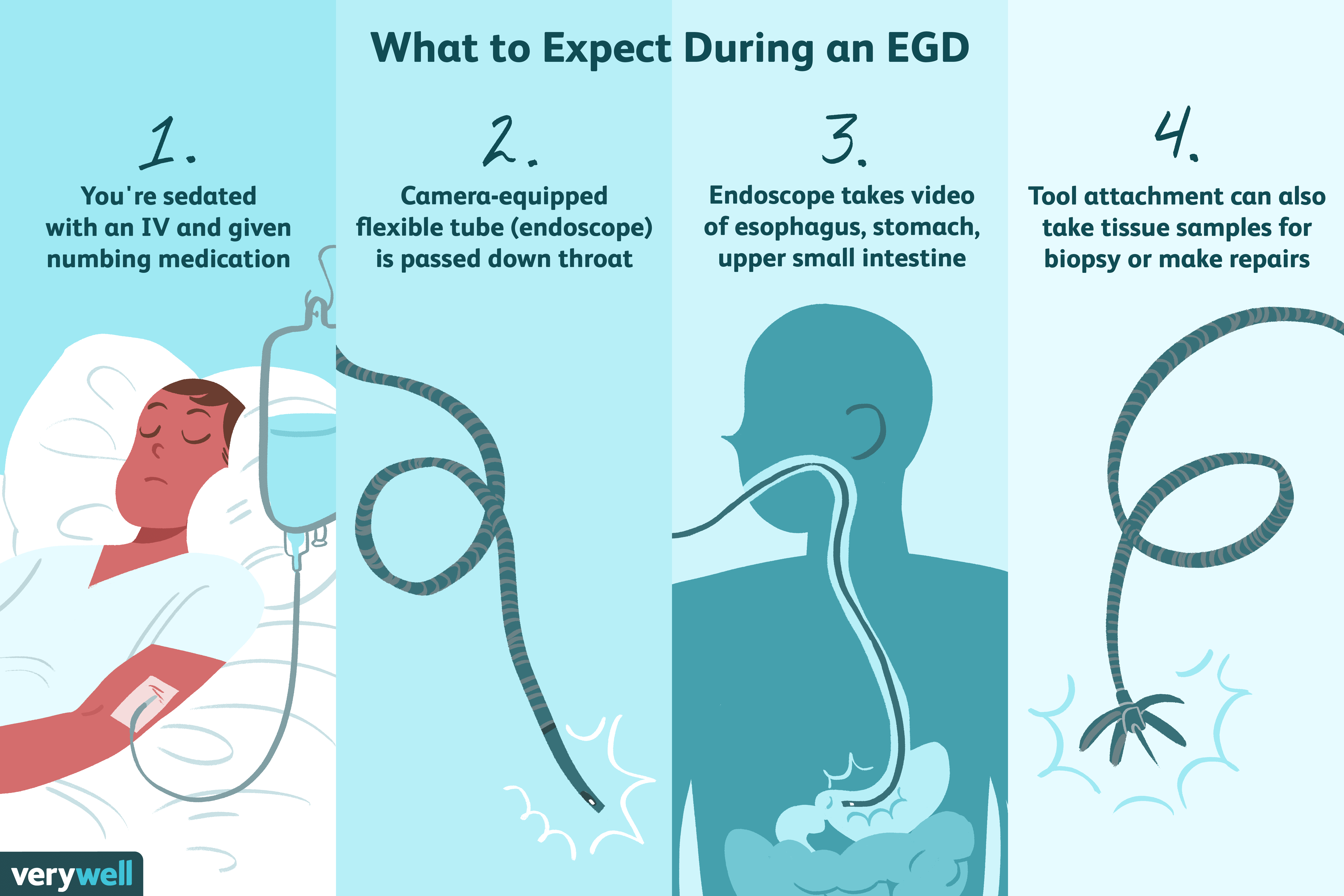 How long should you rest after an endoscopy?