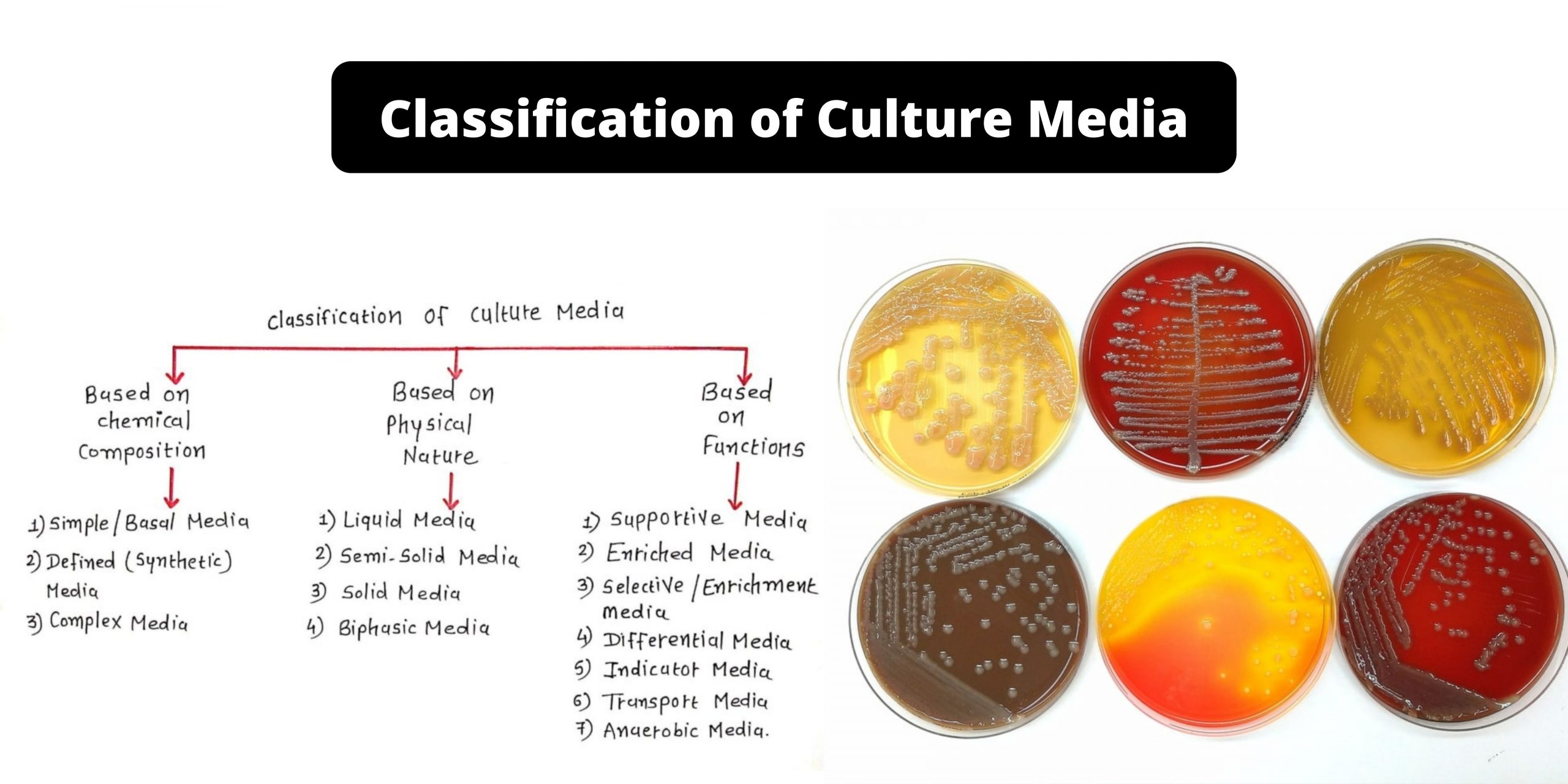 How to classify bacterial culture media on the basis of classification?