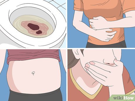 How to stop constipation fast?