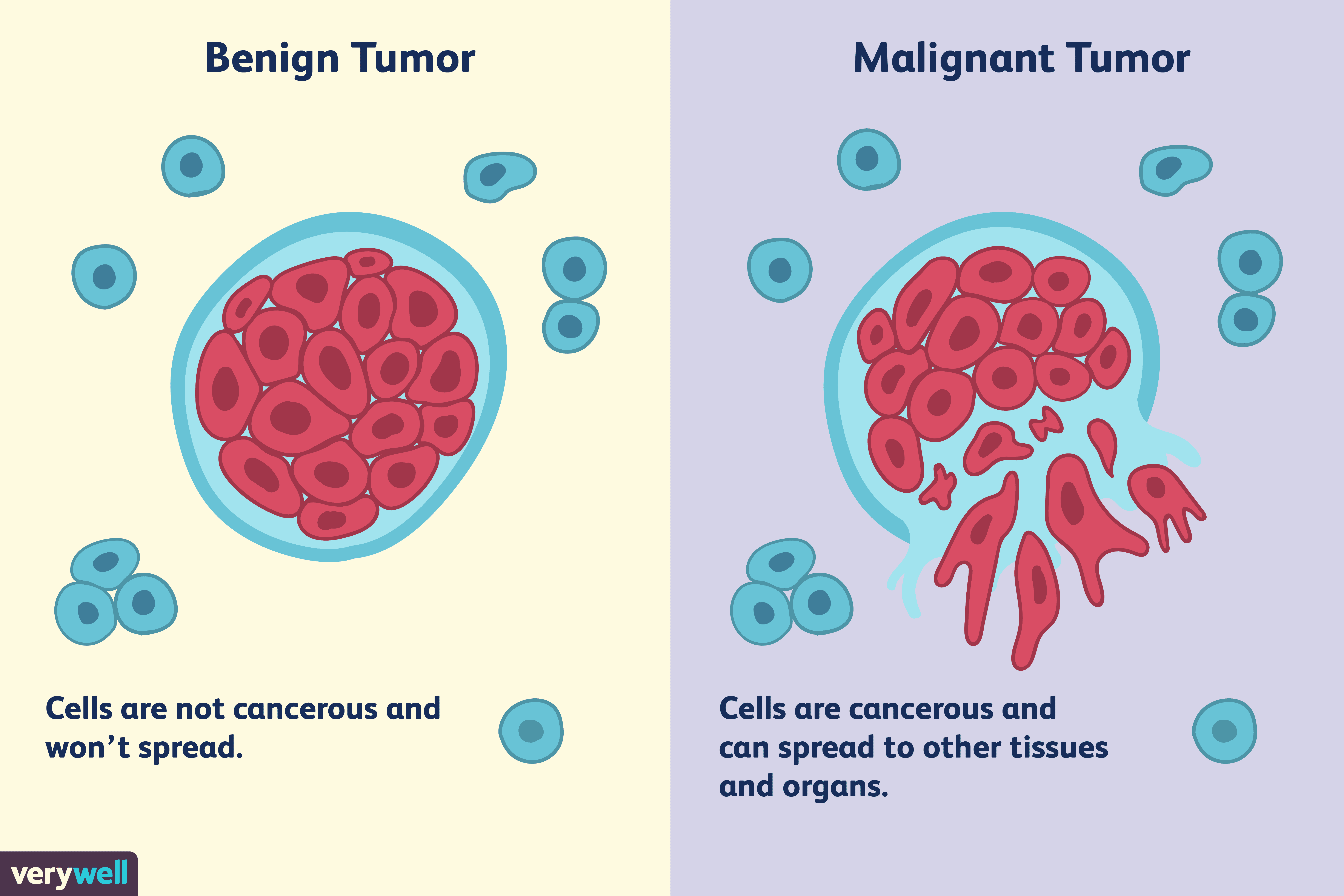 Is a tumor a lump of cells?