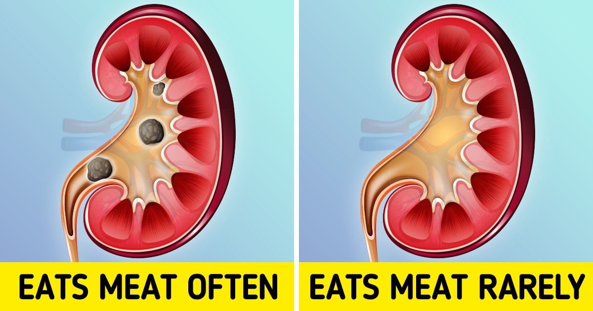 Is it bad to eat too much meat?