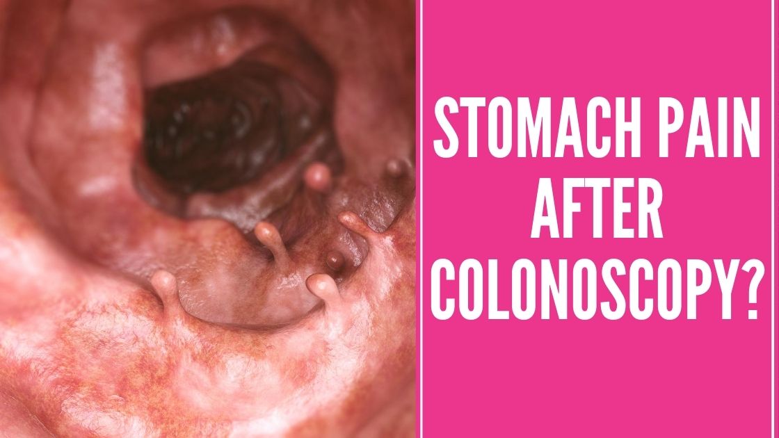 Is it normal to have air in your stomach after colonoscopy?
