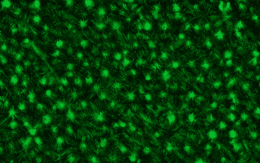 Is phospholipids good or bad?