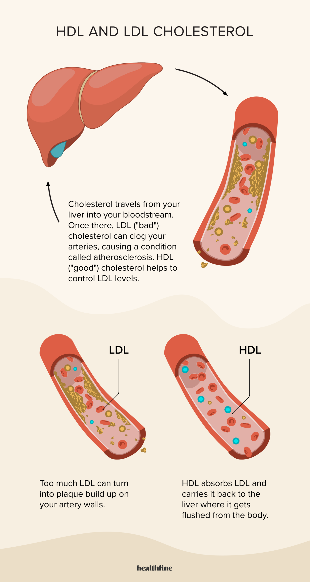 Is protein harmful for cholesterol?