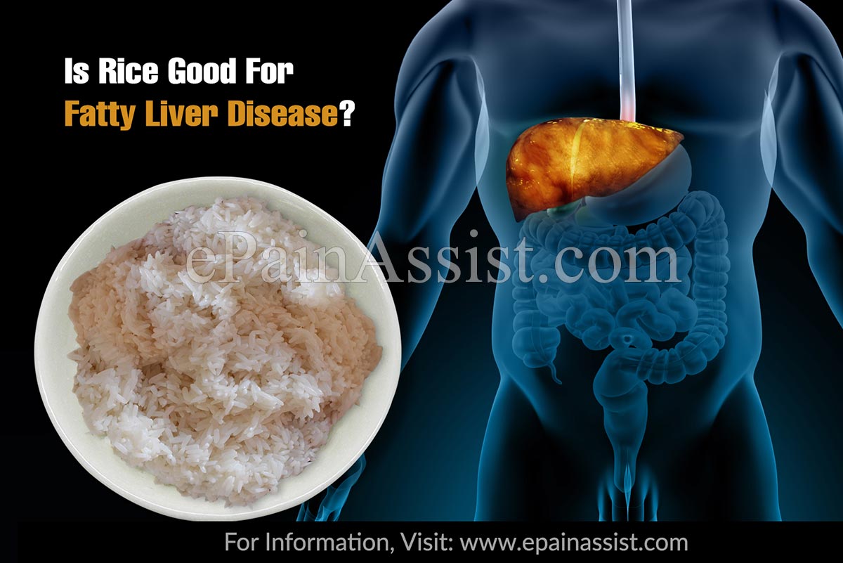 Is rice good for fatty liver?