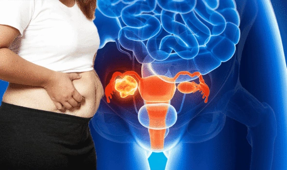 Is stomach bloating life threatening?