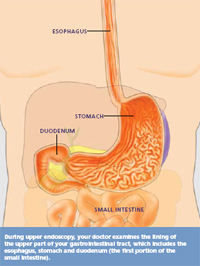 Is stomach pain normal after endoscopy?