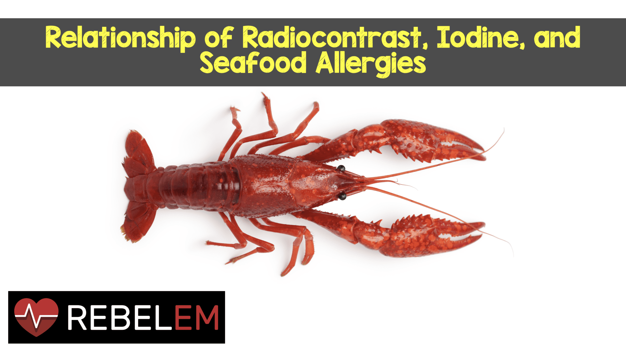 Is there a link between iodine and shellfish allergy?