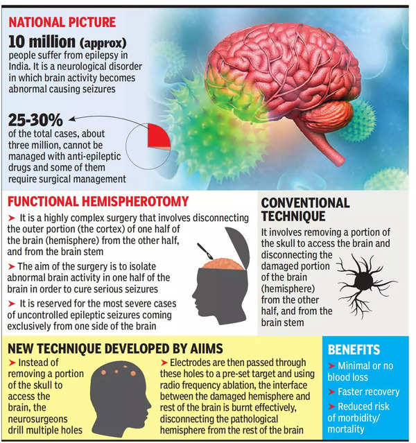 Is there any hope for epilepsy?