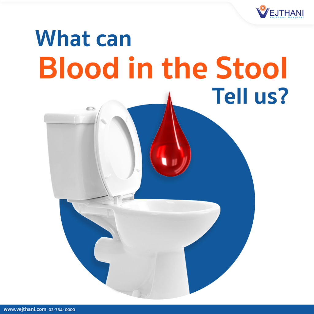 Should I go to the hospital for bloody mucus in stool?