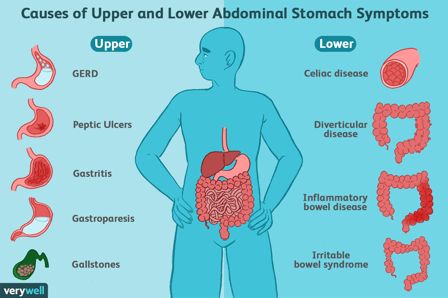 What are 3 common signs and symptoms of digestive disorders?
