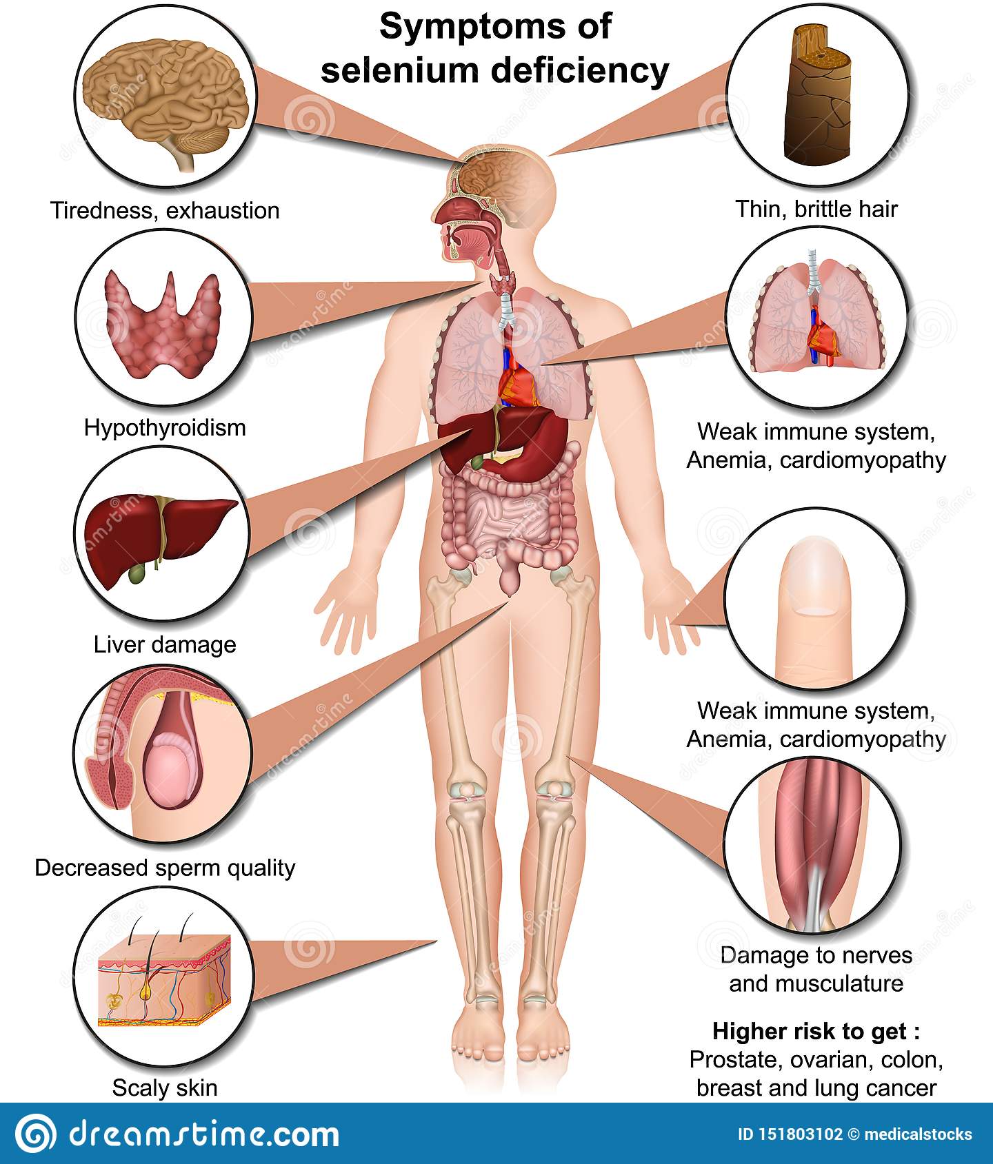 What are selenium deficiency symptoms?