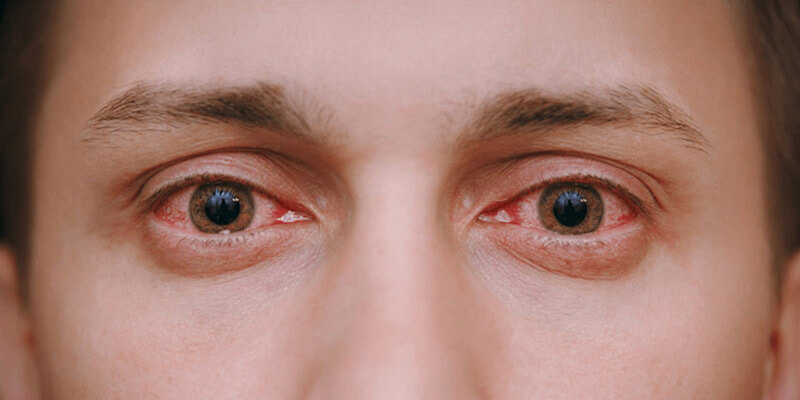 What are symptoms of serious eye problems?