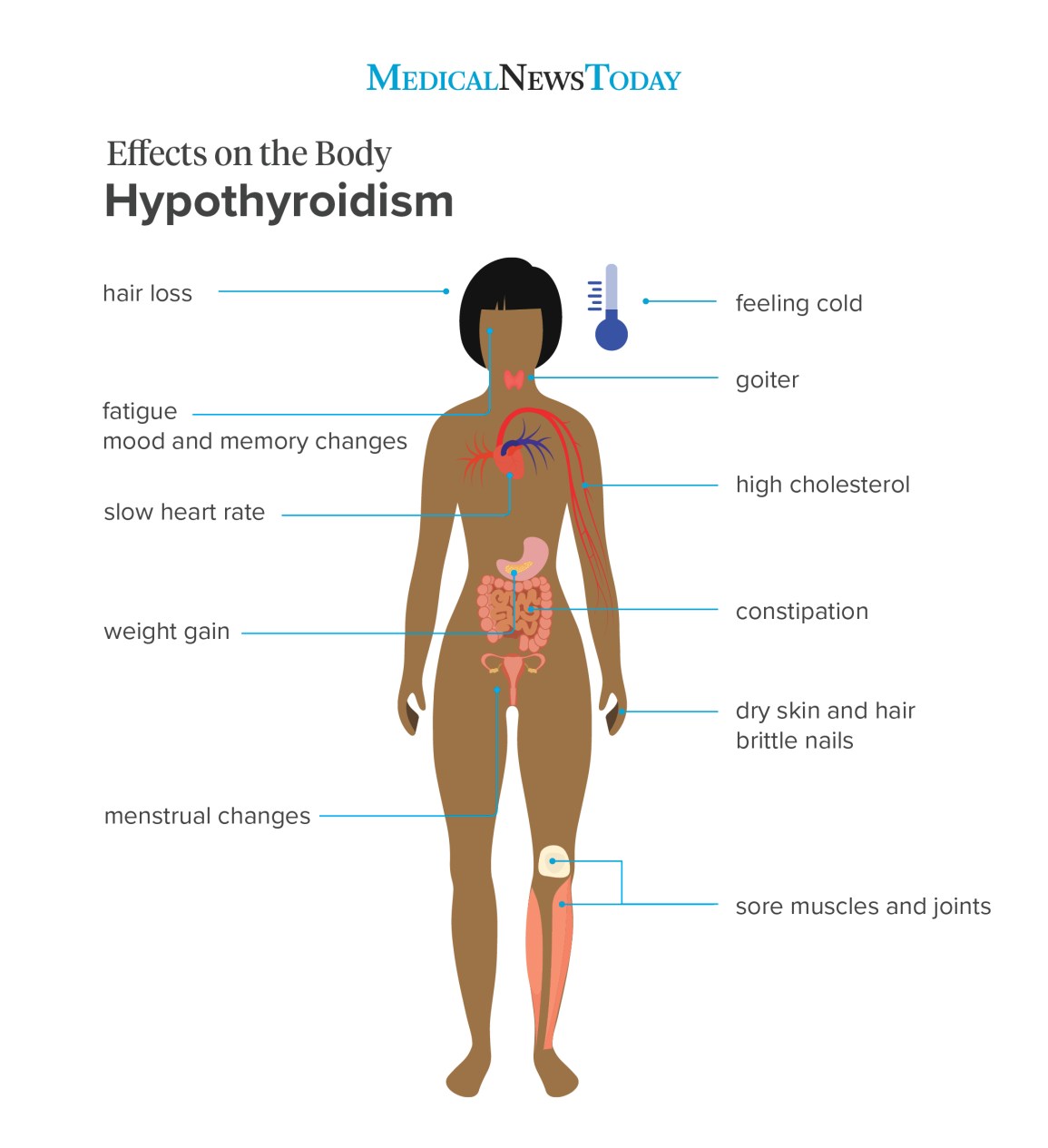 What are symptoms of thyroid problems in females?
